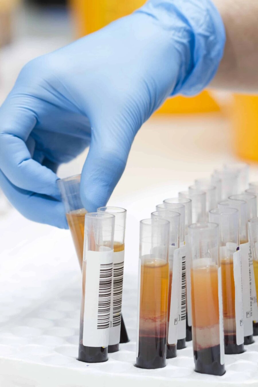 Integrating Lab Automation: Efficient Laboratory Management - Computype