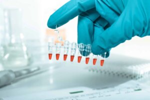 How to Effectively Label Small PCR Tubes and Strips - Computype